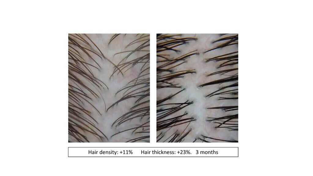 GroTrack Hair Growth Analysis System - Alternity Healthcare